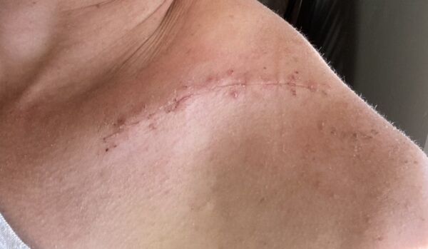 Surgery and Slings: Just Another Day Around Horses - Horse Rookie